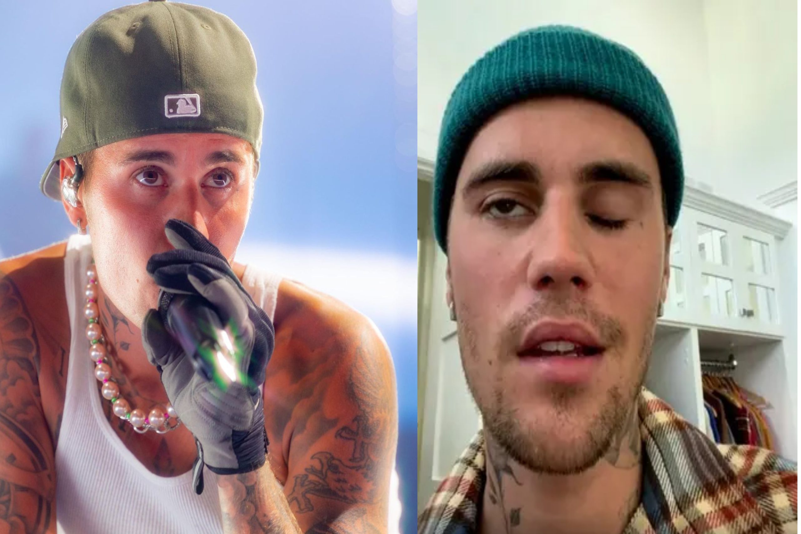 Watch: Celebrity Justin Bieber reveals he's been struck by facial ...