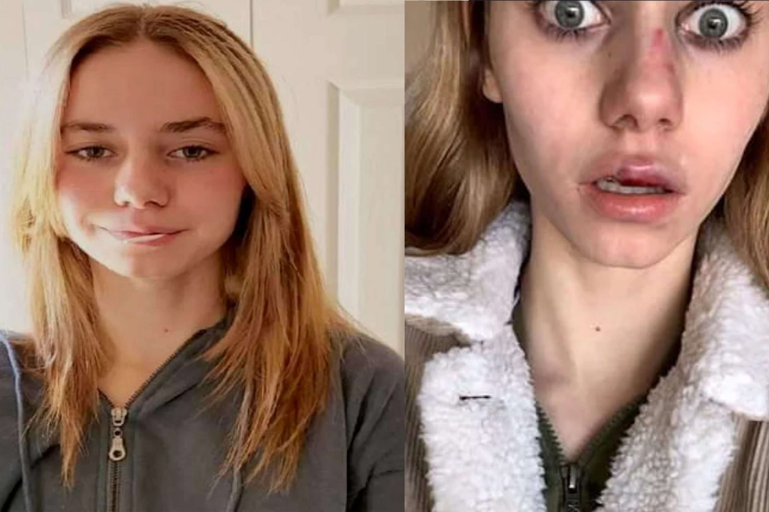 New Jersey Teen Suicide Update: School Superintendent Triantafillos Parlapanides Blames Teen’s ...