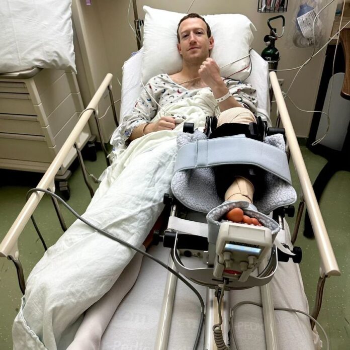 Meta CEO Mark Zuckerberg posts surgery photos after ACL tear, web fans ...